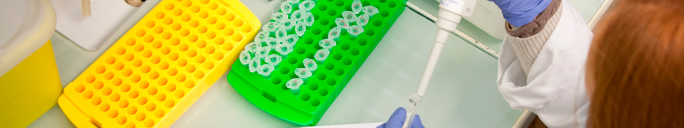 Alzprotect - Alzprotect Completes Phase 2a Clinical Trial Enrollment ...